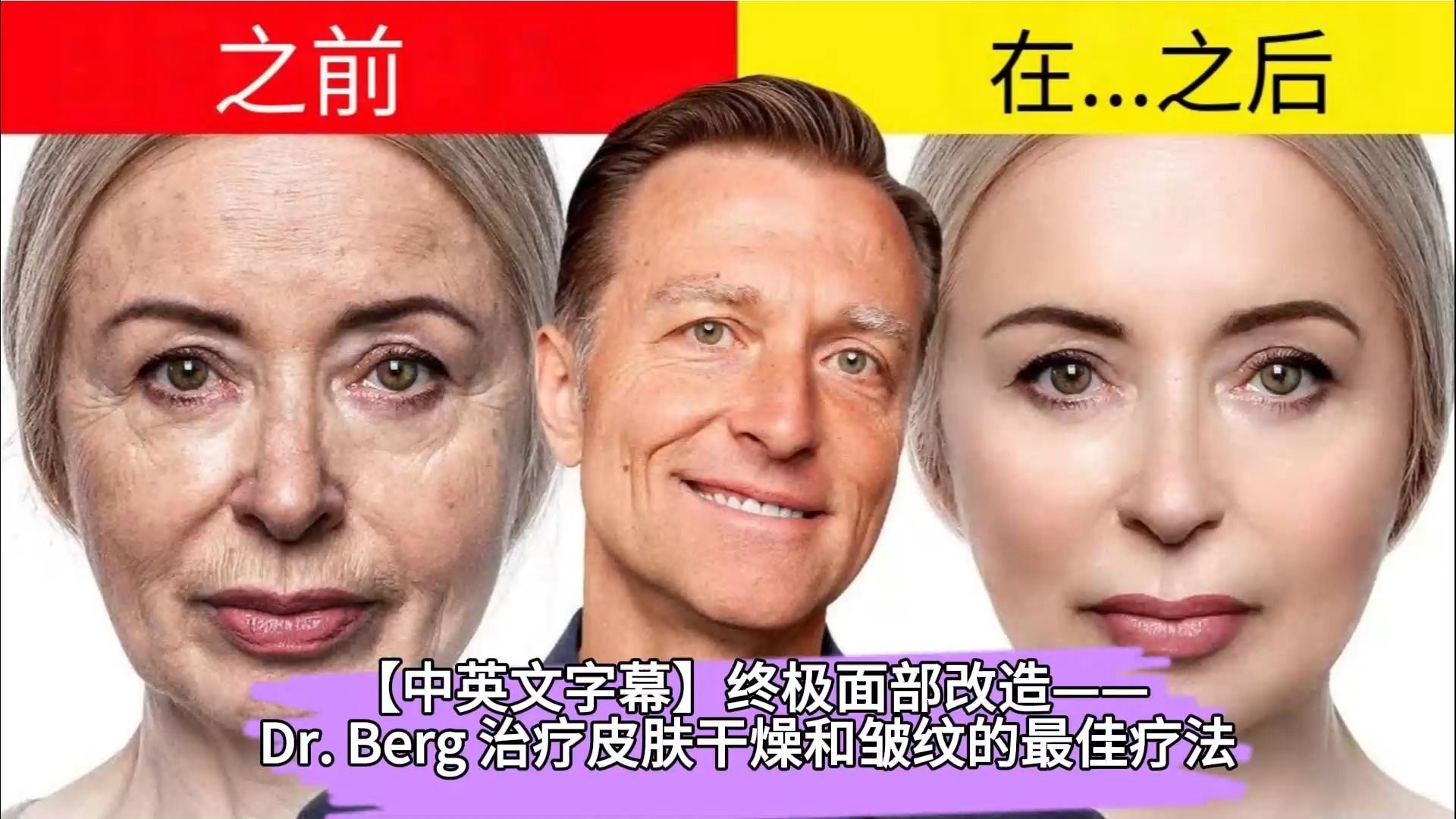 ...英文字幕】终极面部改造——Dr. Berg 治疗皮肤干燥和皱纹的最佳疗法