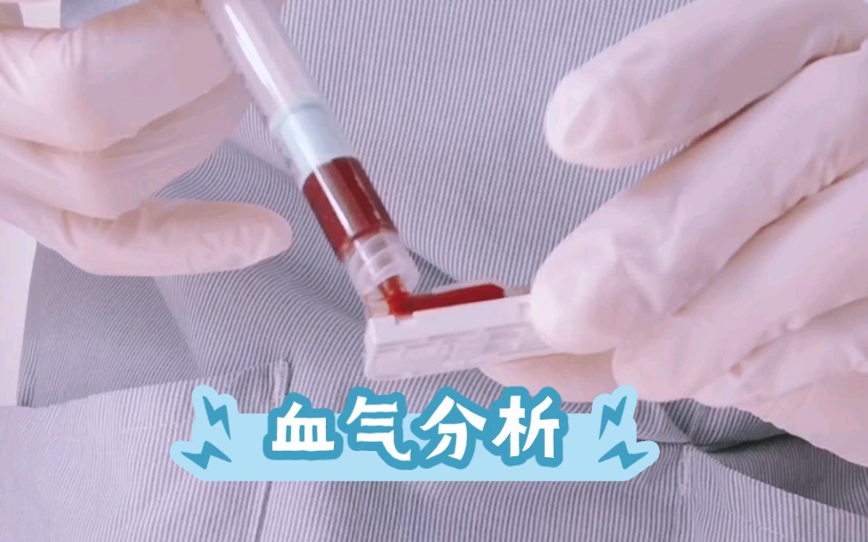 瑞典护士工作日常-血气分析