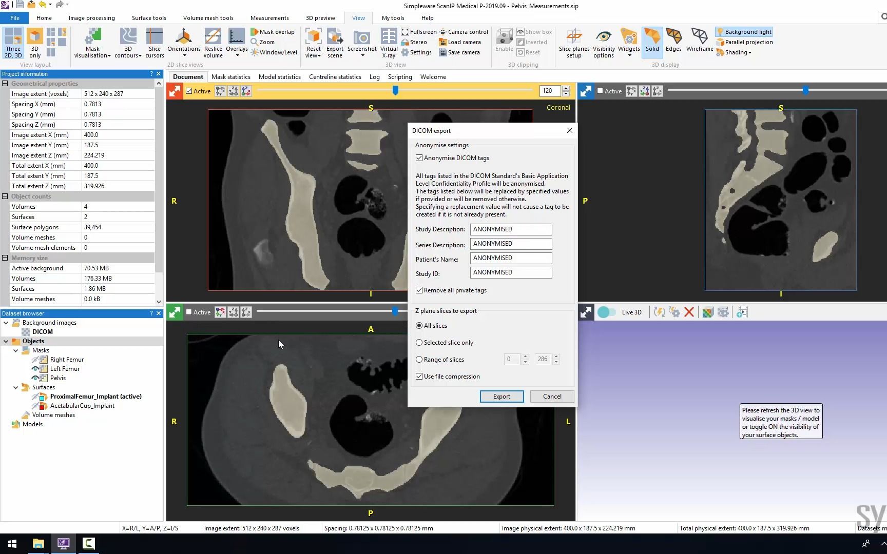【Simpleware Tips】导出 DICOM 数据