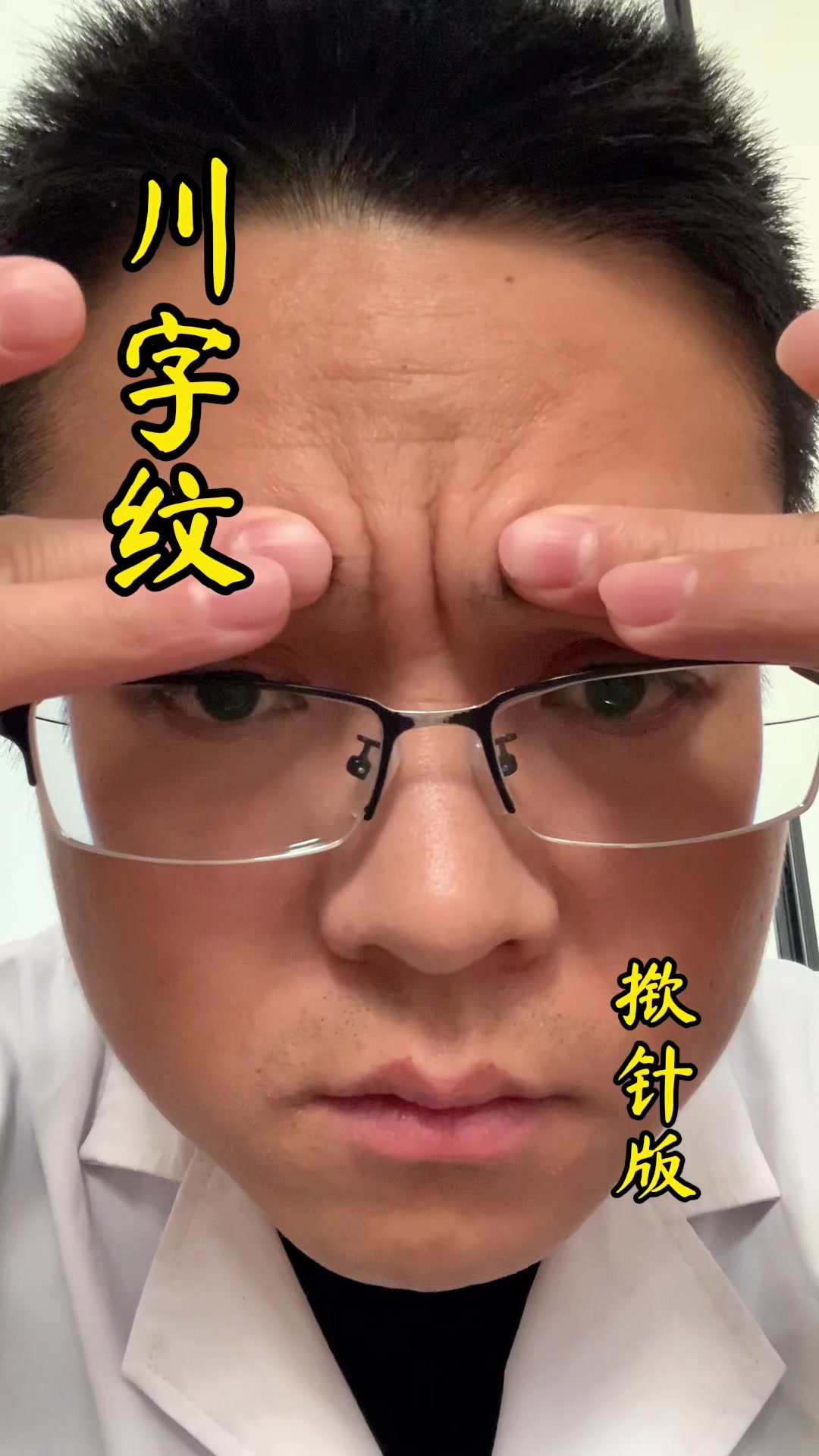 川字纹 揿针版 #川字纹 #中医 #揿针