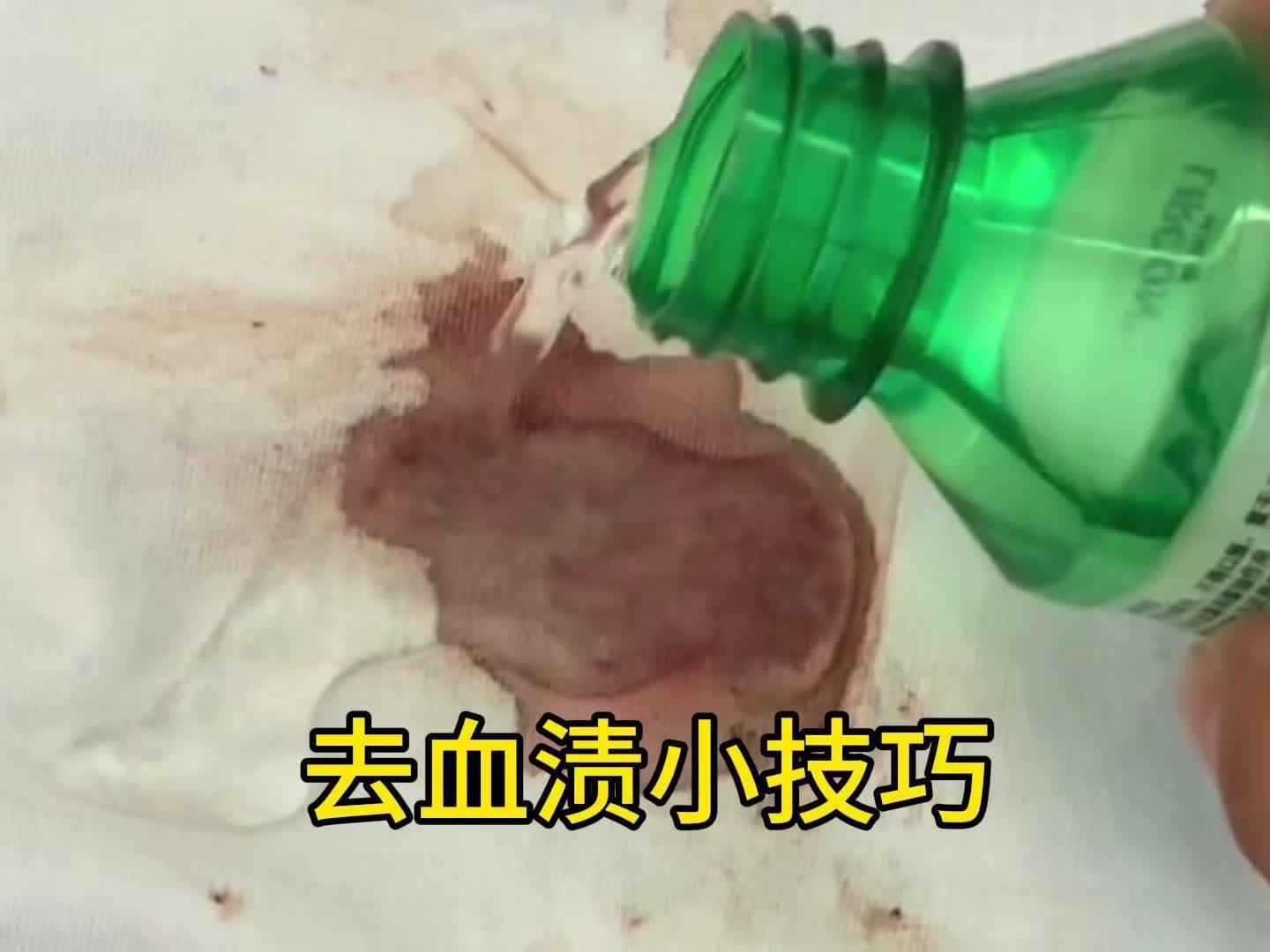 去除血渍实用小技巧!一起看看