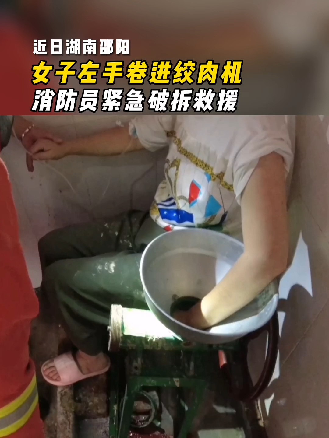 看着就疼!安全作业真的很重要!!