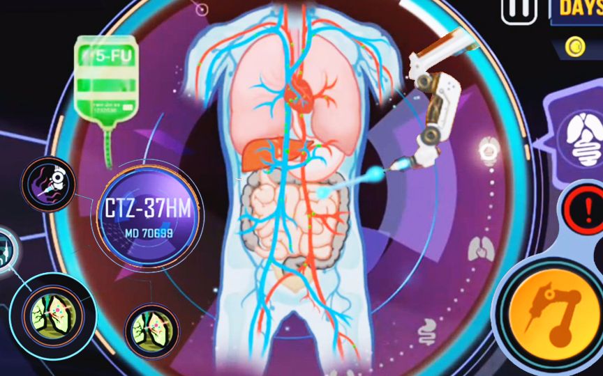 【小熙解说】肿瘤医生 模拟一个肿瘤医生运用先进技术治疗癌症和...