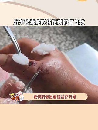 ...野外不小心被毒蛇咬到了,我们该如何自救?#蛇类科普 #毒蛇咬伤自救 ...
