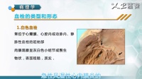 第三章 局部血液循环障碍 第三节 血栓形成 2.血栓的类型和形态