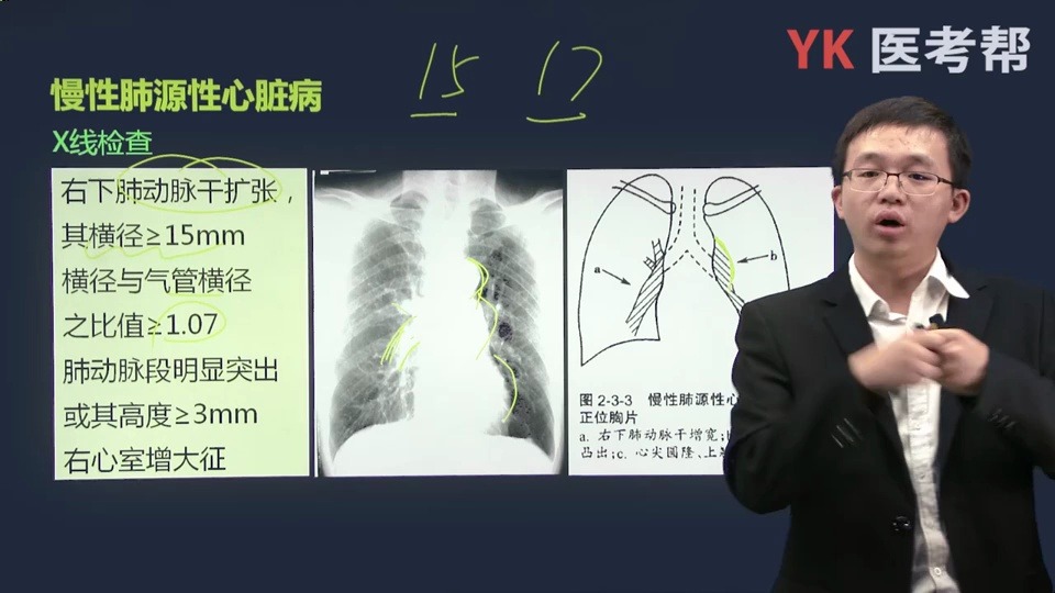 2-11 02.慢性肺源性心脏病的临床表现、辅助检查、治疗、实战演练