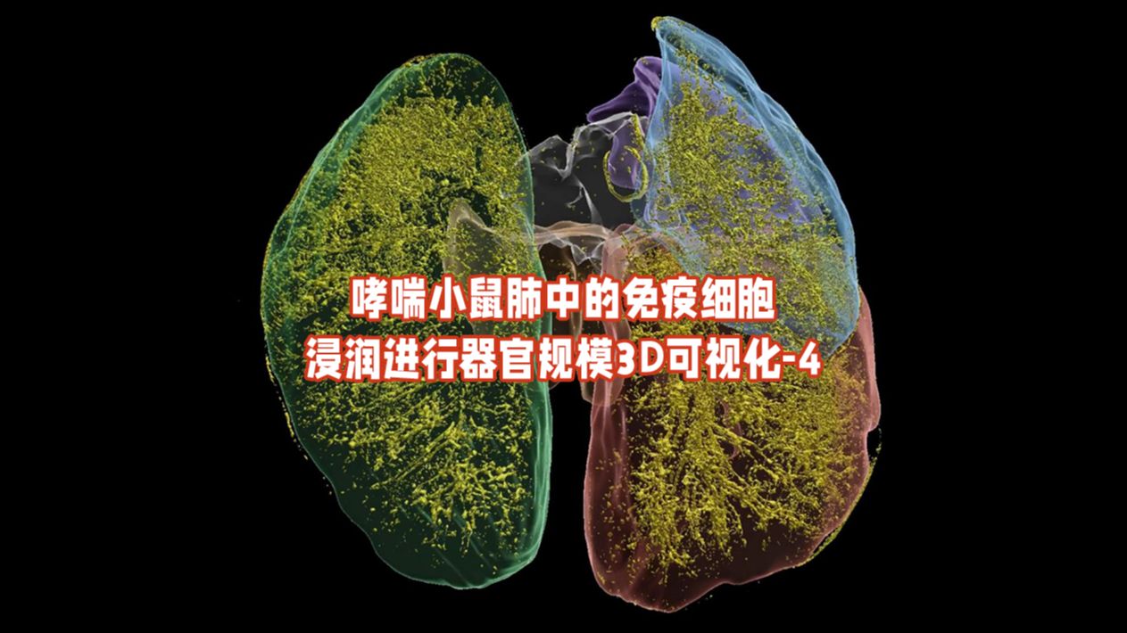 哮喘小鼠肺中的免疫细胞浸润进行器官规模3D可视化-4