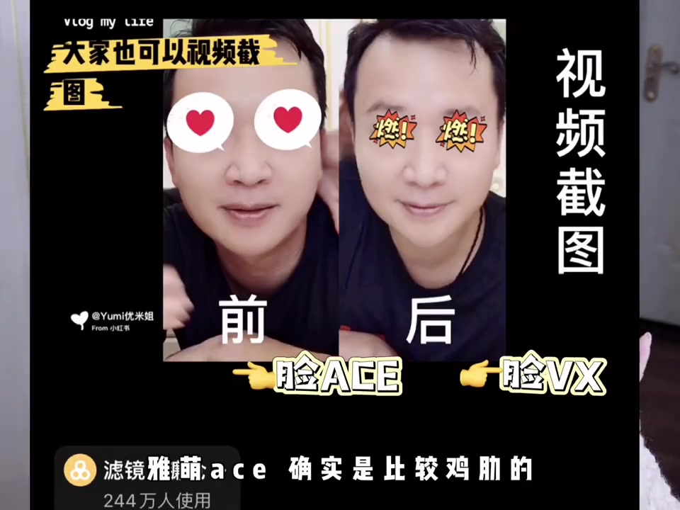 美容仪 美容仪测评 雅萌ACE Tripollar VX使用一年真实反馈