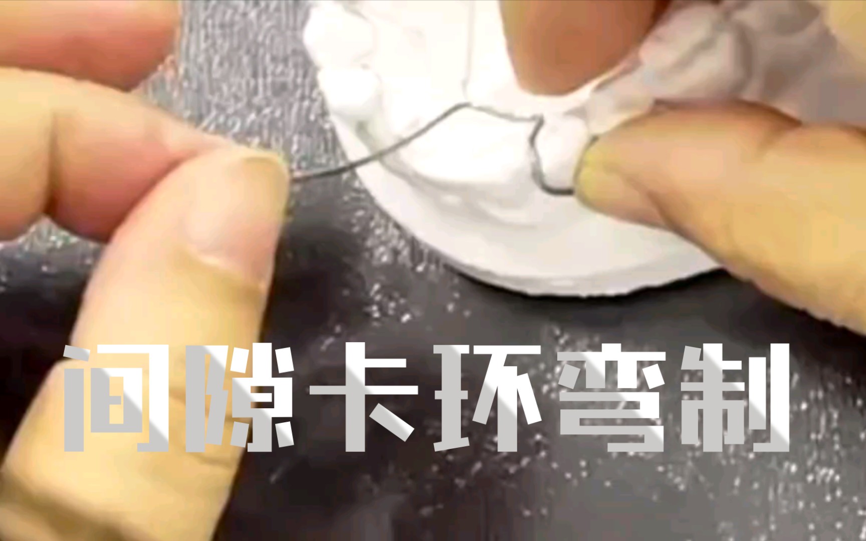 【口修】间隙卡环弯制