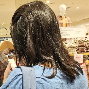 坐骨神经麻痹 