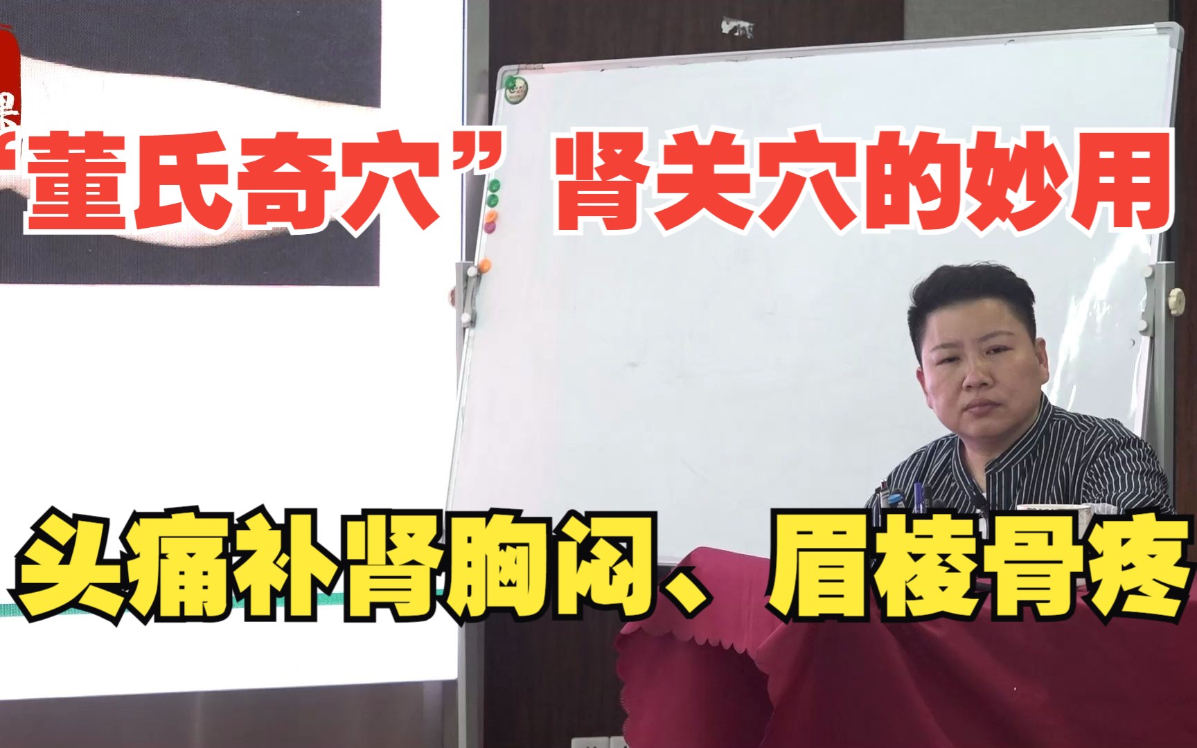 “董氏奇穴”肾关穴的妙用、头痛、补肾胸闷、眉棱骨疼