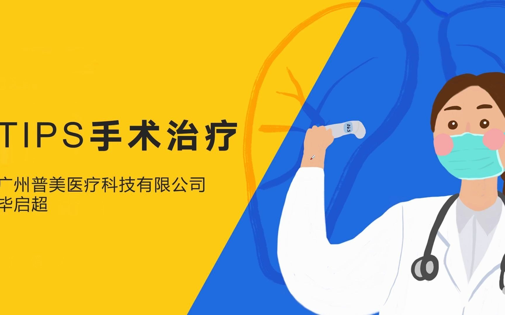 (一)TIPS手术的历史与发展