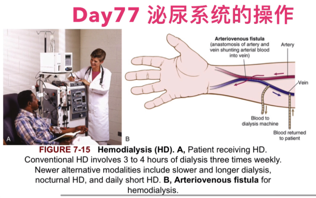 「医学英语学习分享」泌尿系统的操作