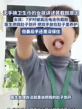 ...其截肢原因:7岁时被高压电击伤。#无手女孩 #残疾人正能量 #卫生巾