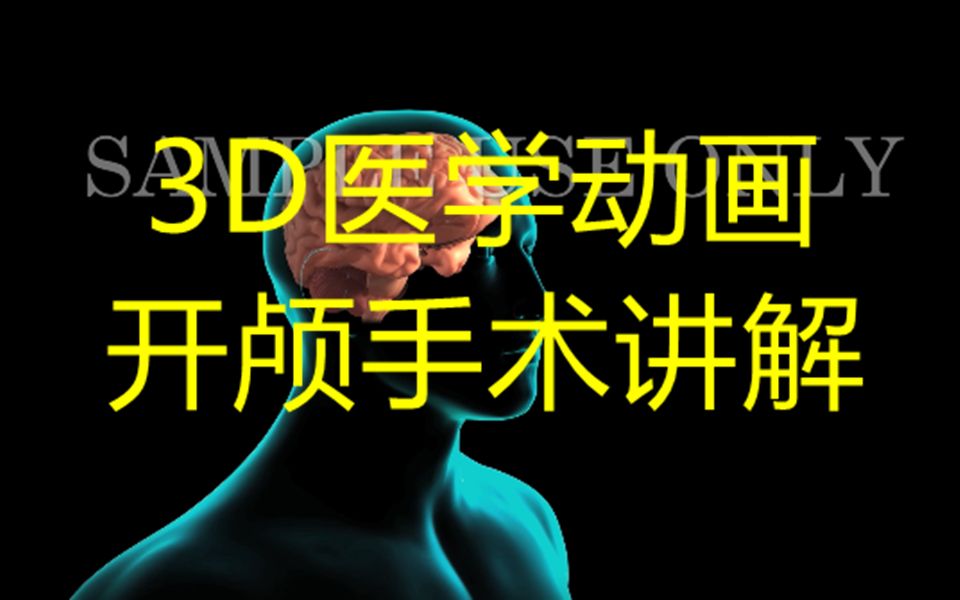 ...会推荐开颅手术或开颅手术来治疗多种不同的脑部疾病、损伤或病症。