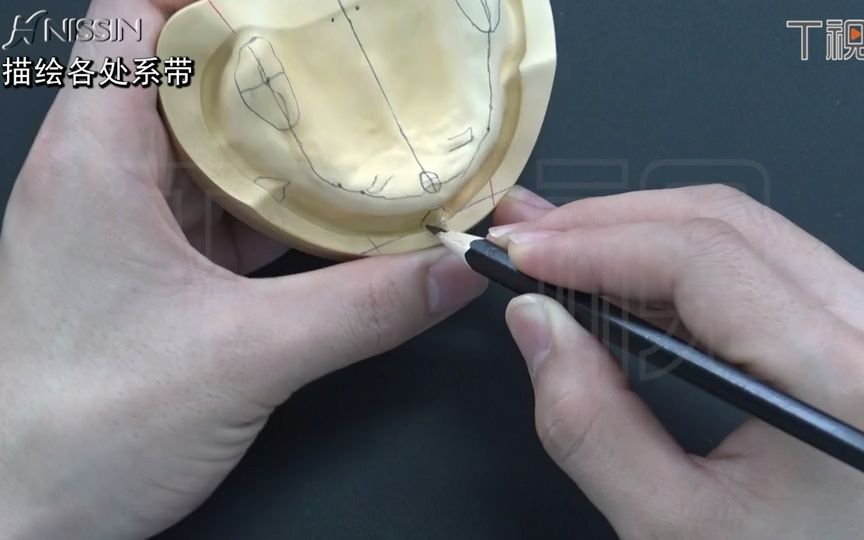 01-石膏模型画线分析