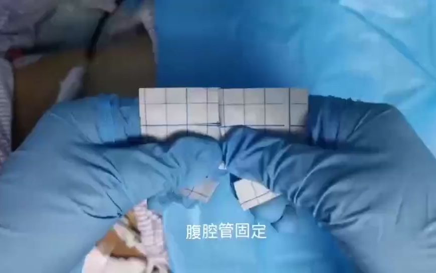 留置导管护理小常识