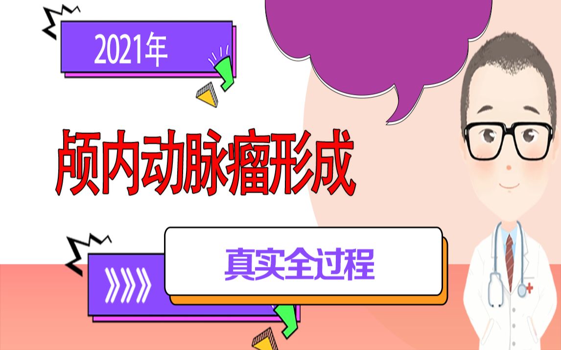 神经内科颅内动脉瘤形成术过程动画模拟演示!