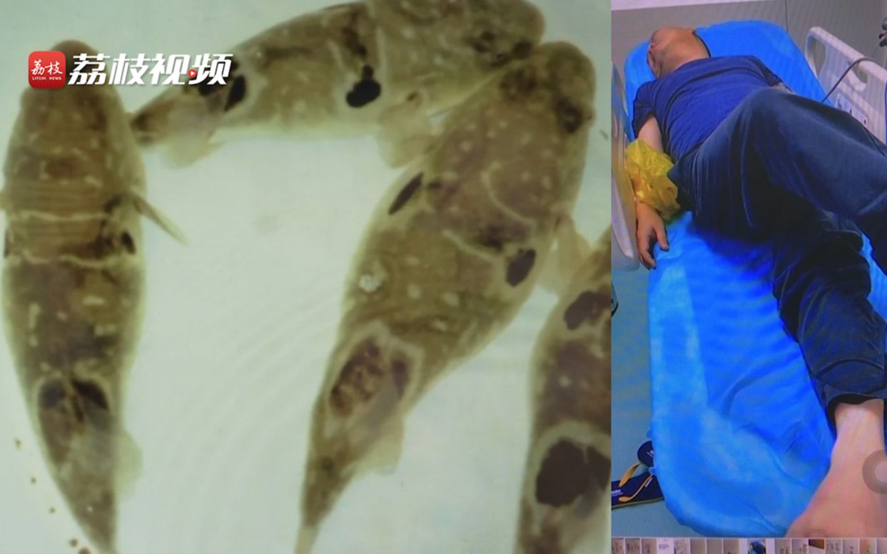 请客吃河豚双双中毒,牵出一起长江非法捕捞案