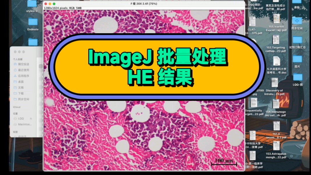 ImageJ 批量处理 HE 结果。HE染色,细胞染色,油红o,细胞实验,克隆...