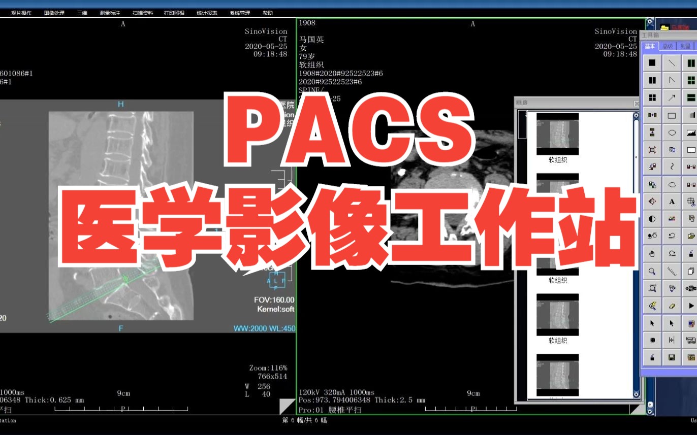 VC++6.0开发的PACS医学影像工作站 DICOM标准化开发