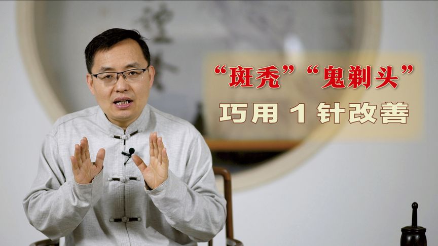 “鬼剃头”多是血虚受风,中医教你1个妙招,改善斑秃,简洁有效
