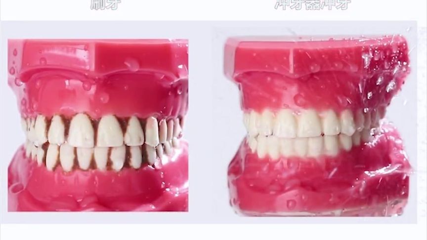 冲牙器、洗牙器、水牙线的使用方法