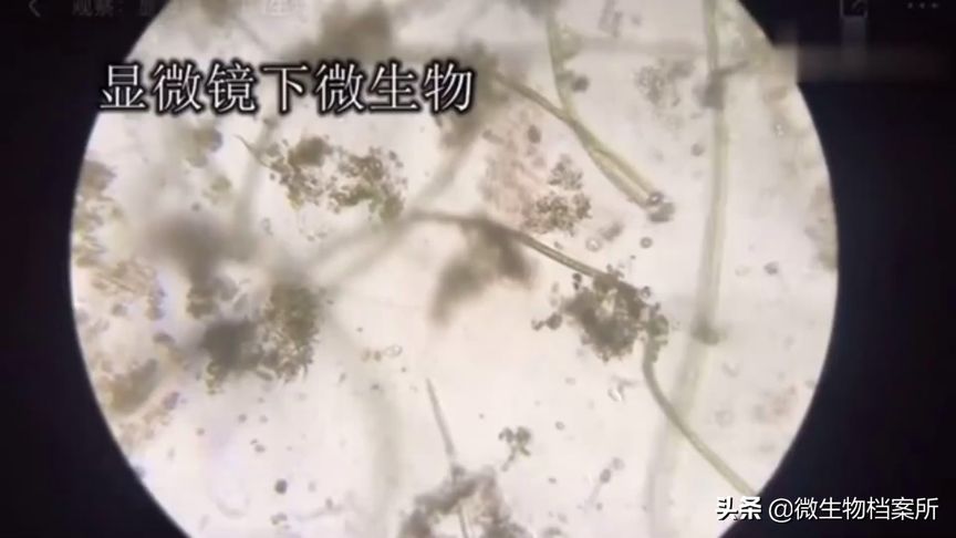 显微镜下的微生物世界
