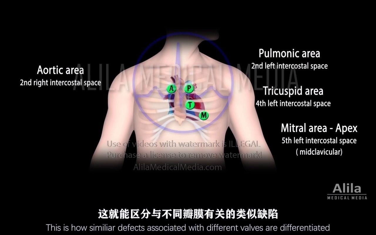 【Alila Medical Media】31.心音和心脏杂音