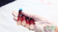 04可视回血采血针