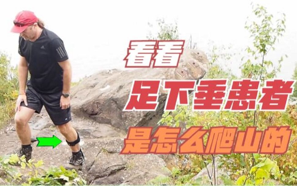 来看看足下垂患者是怎么爬山的!