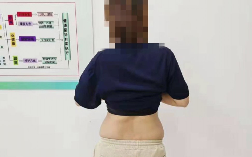 肥胖的标准不仅仅看体重指数,还有个重要的指标是腹围