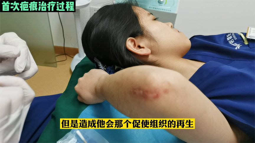 你的疤痕还能修复吗?医生带你了解疤痕的预防与治疗