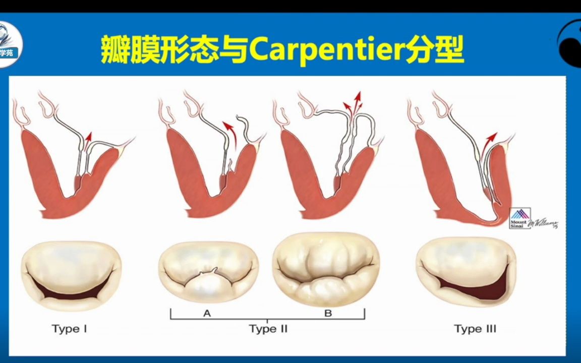 5心脏瓣膜反流评估:超声实用技能详解