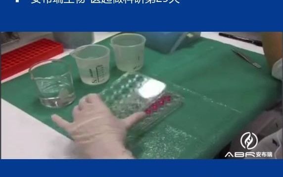【生物医学实验室日常】Transwell检测细胞迁移实验技巧