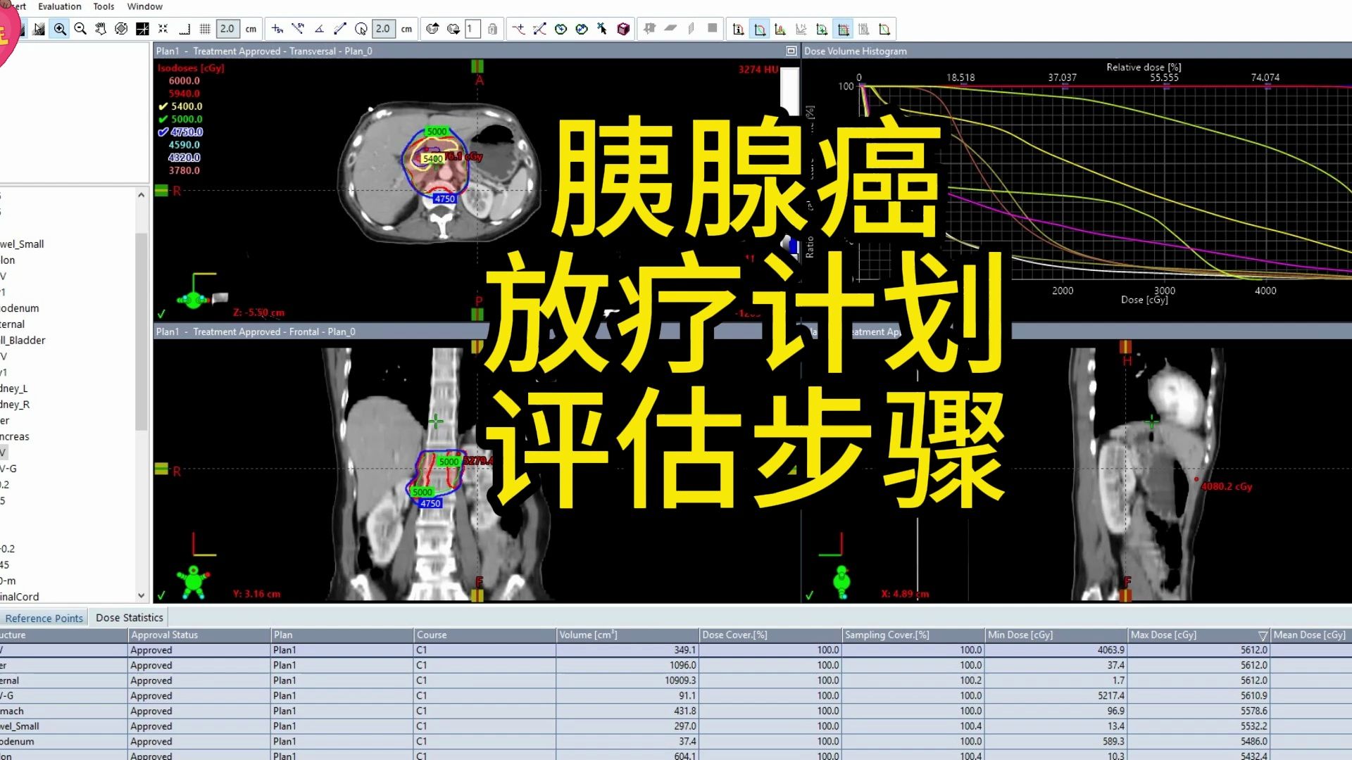 快速掌握胰腺癌放疗计划评估步骤,瓦里安Eclipse放疗系统