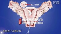 子宫输卵管造影检查系列之双腔球囊导管的插管技巧