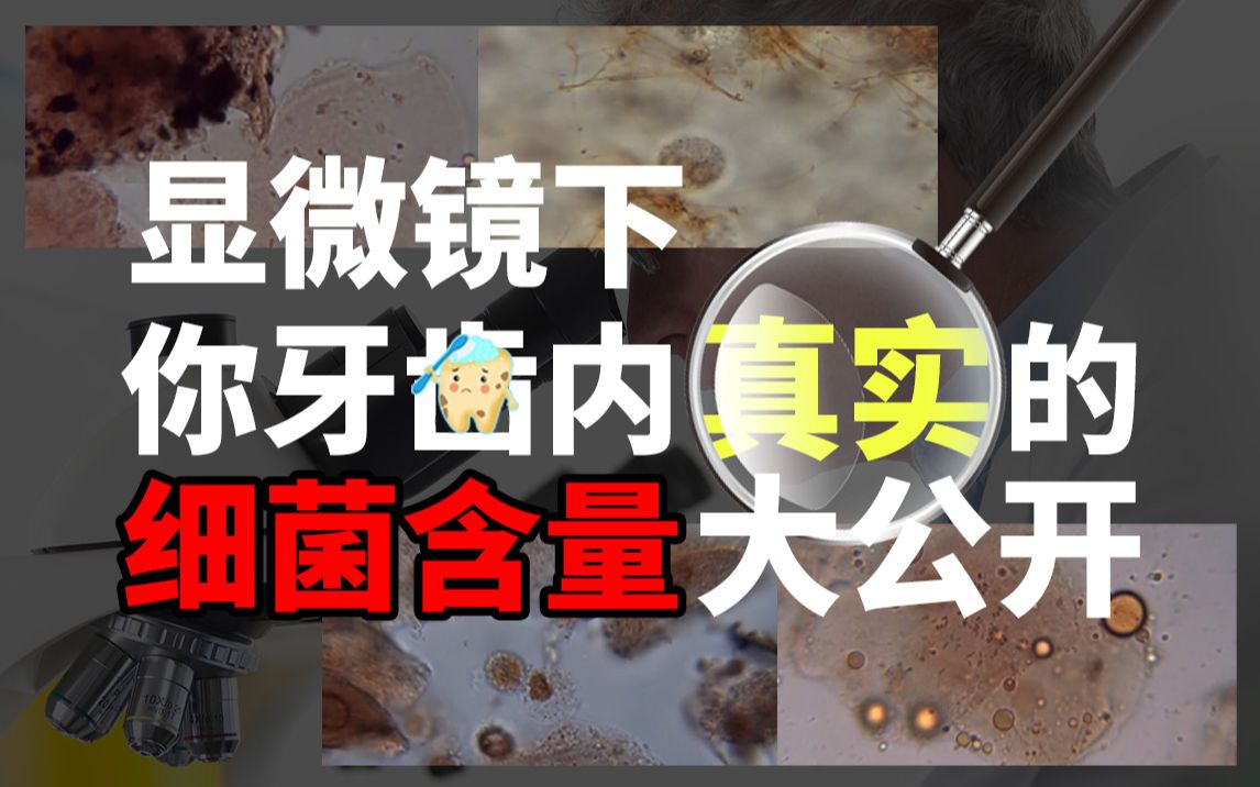 【萌牙科普】显微镜下,牙齿内真实的细菌含量大公开