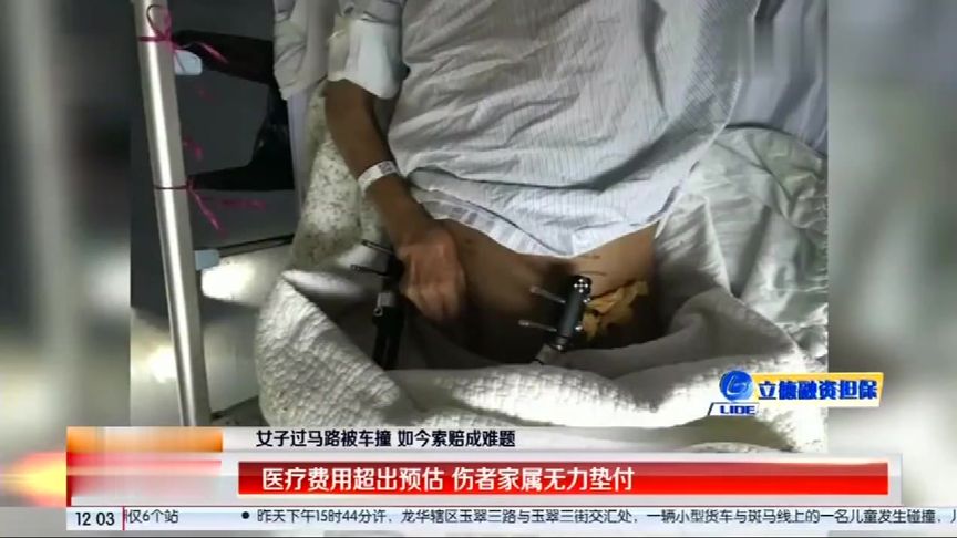 女子过马路被车撞,肇事车辆逆向行驶,如今索赔成难题