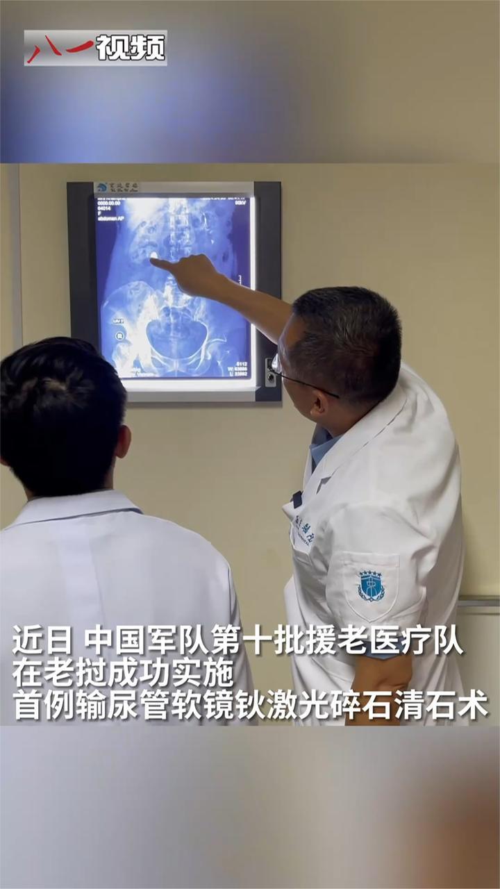 中国军医在老挝成功实施首例输尿管软镜钬激光碎石清石术