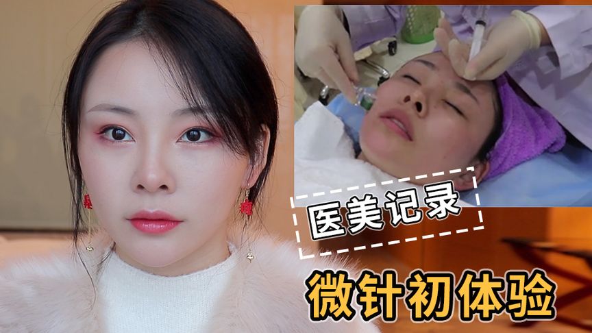 医美拯救瑕疵!我的微针初体验 | 皮肤变化超明显?