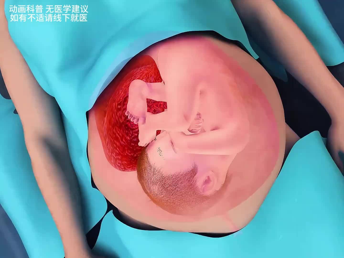 剖腹产的过程 可怕的剖腹产
