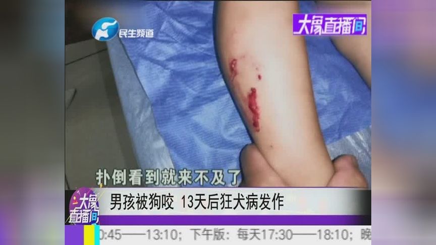 男孩被狗咬 13天后狂犬病发作