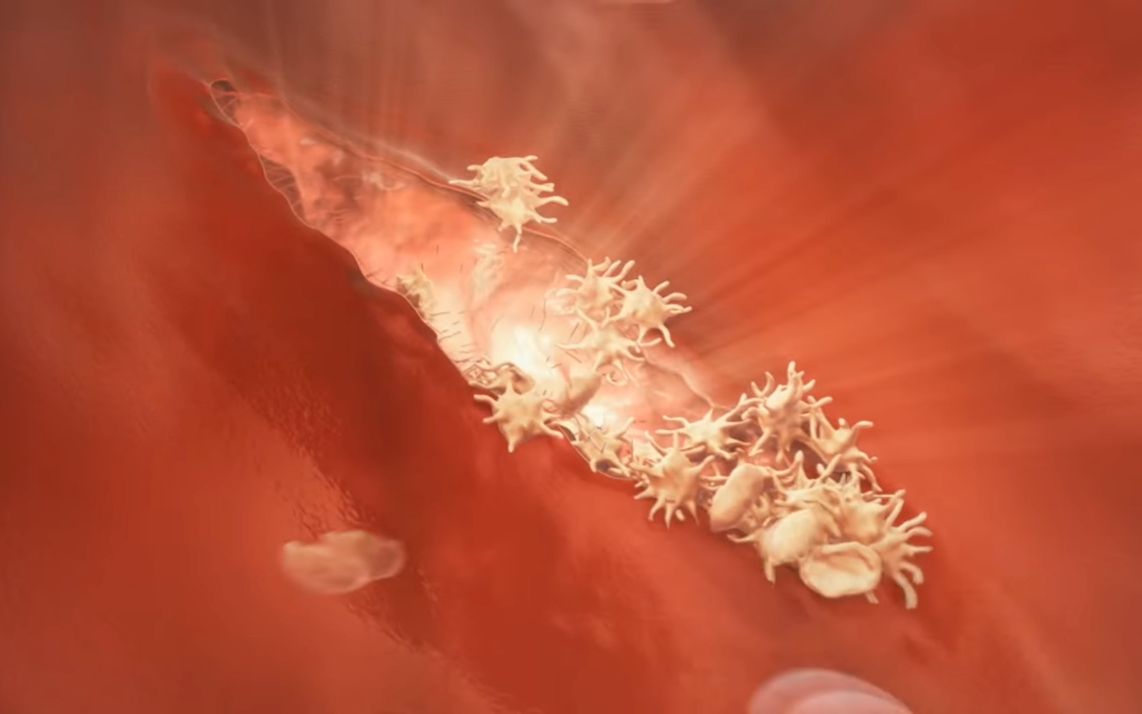 【中英双字】伤口如何愈合、结痂何以形成(凝血过程科普).血友病治病...