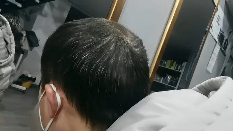 从审计工程师的白发中看现代人的压力,无需再为白发焦虑