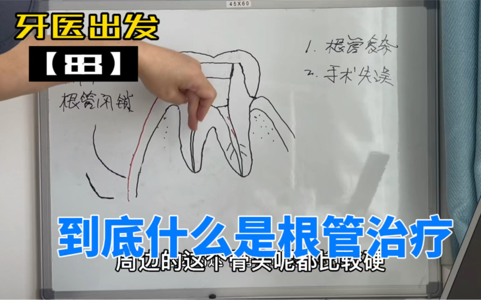 到底什么是“根管治疗”