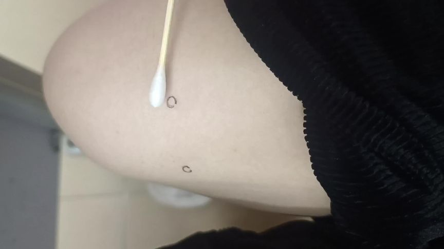 上课扎个针,血海,梁丘。