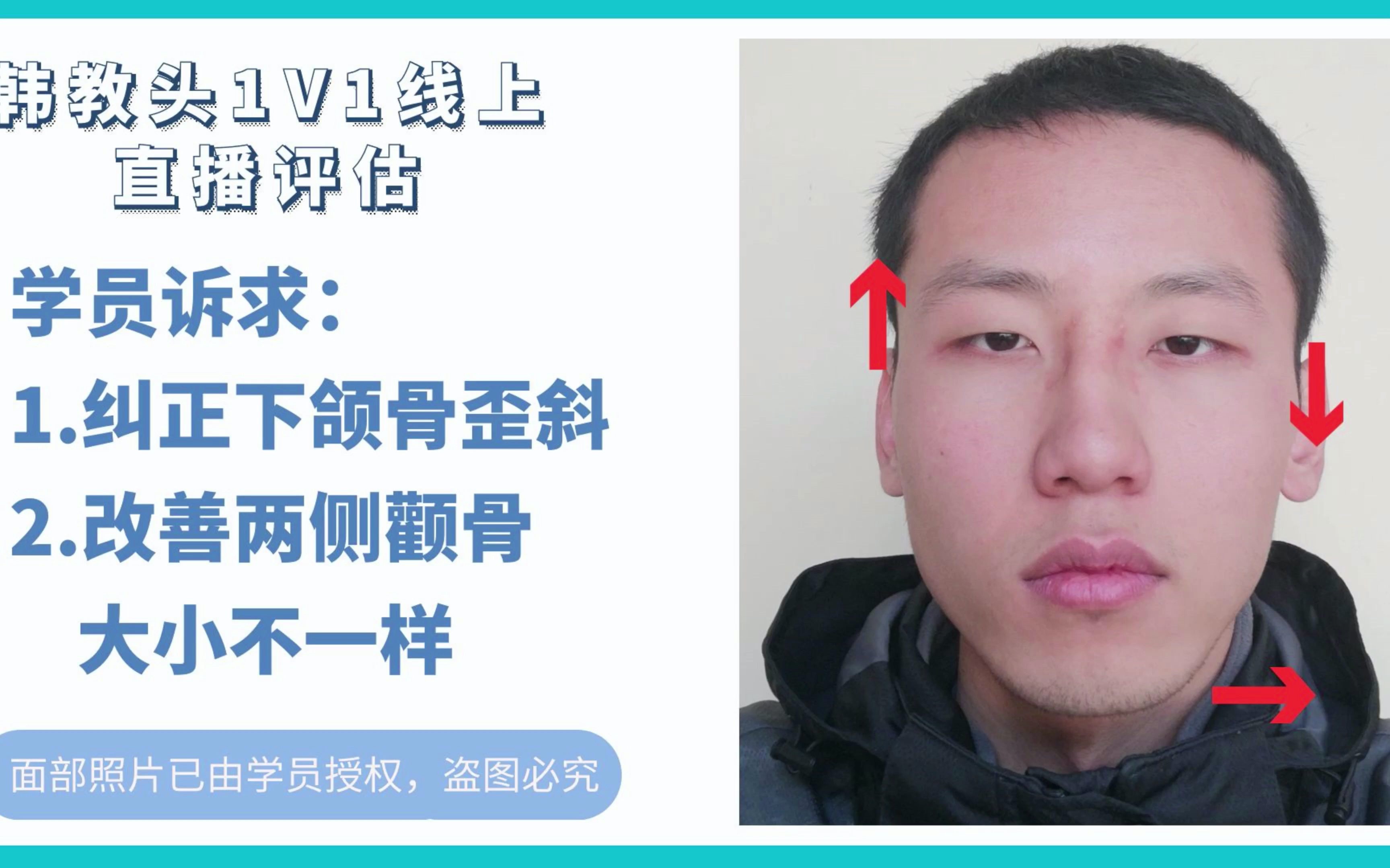 面部纠正训练【下颌骨歪斜/歪下巴➕大小颧骨肌群不对称➕平衡面部...
