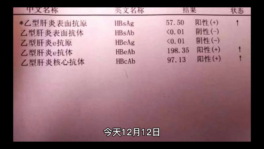 分享一下我抗原阳性了的症状