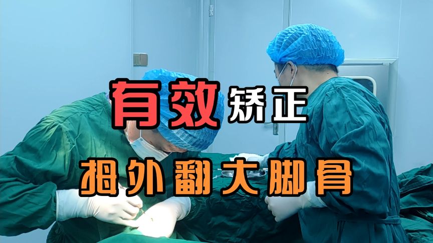 大脚骨手术开始,矫正拇外翻,脚不再疼痛